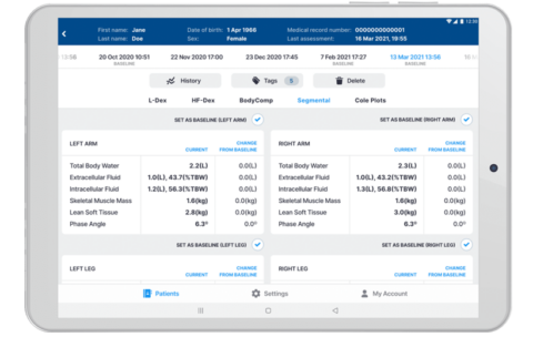 Segmental BodyComp Analysis | Impedimed | Sandbourne Medical